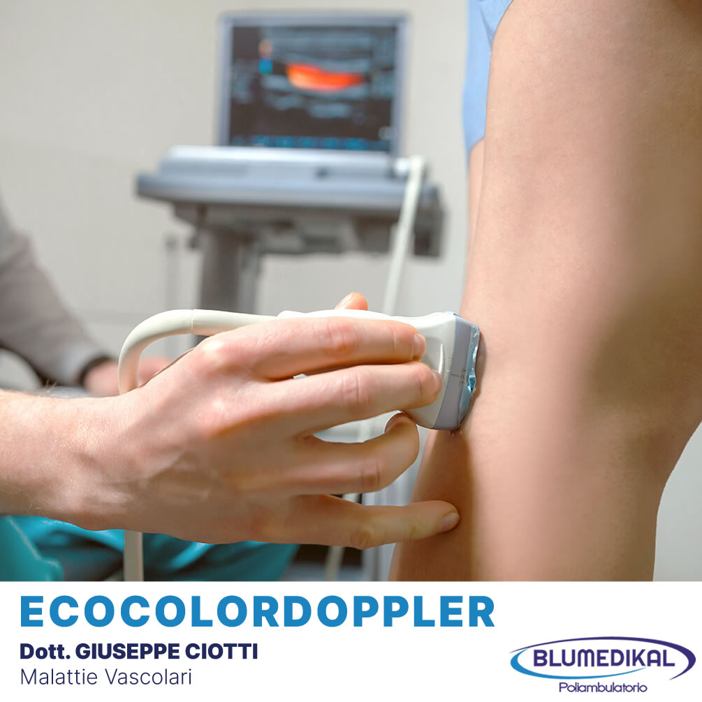 Metodica diagnostica non invasiva: Ecocolordoppler - Blumedikal ...